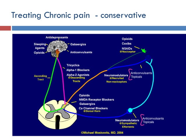 Interventional spine & pain management dr manish raj | PPT