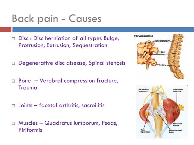 Interventional spine & pain management dr manish raj | PPT