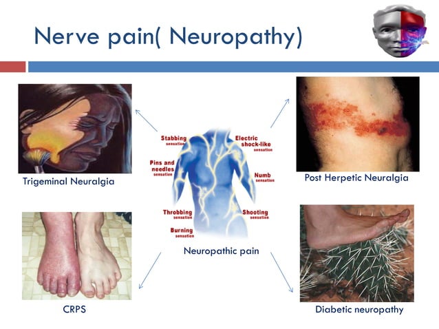 Interventional spine & pain management dr manish raj | PPT