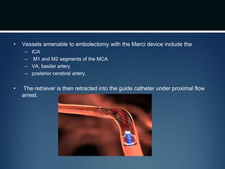 endovascular neurosurgery | PPTX | First Aid | Injuries