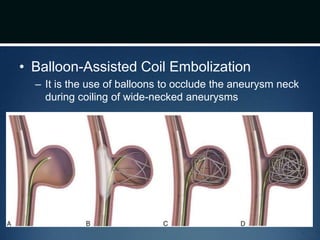 endovascular neurosurgery | PPTX | First Aid | Injuries