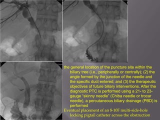 Intervention radiology hepatobiliary system | PPTX