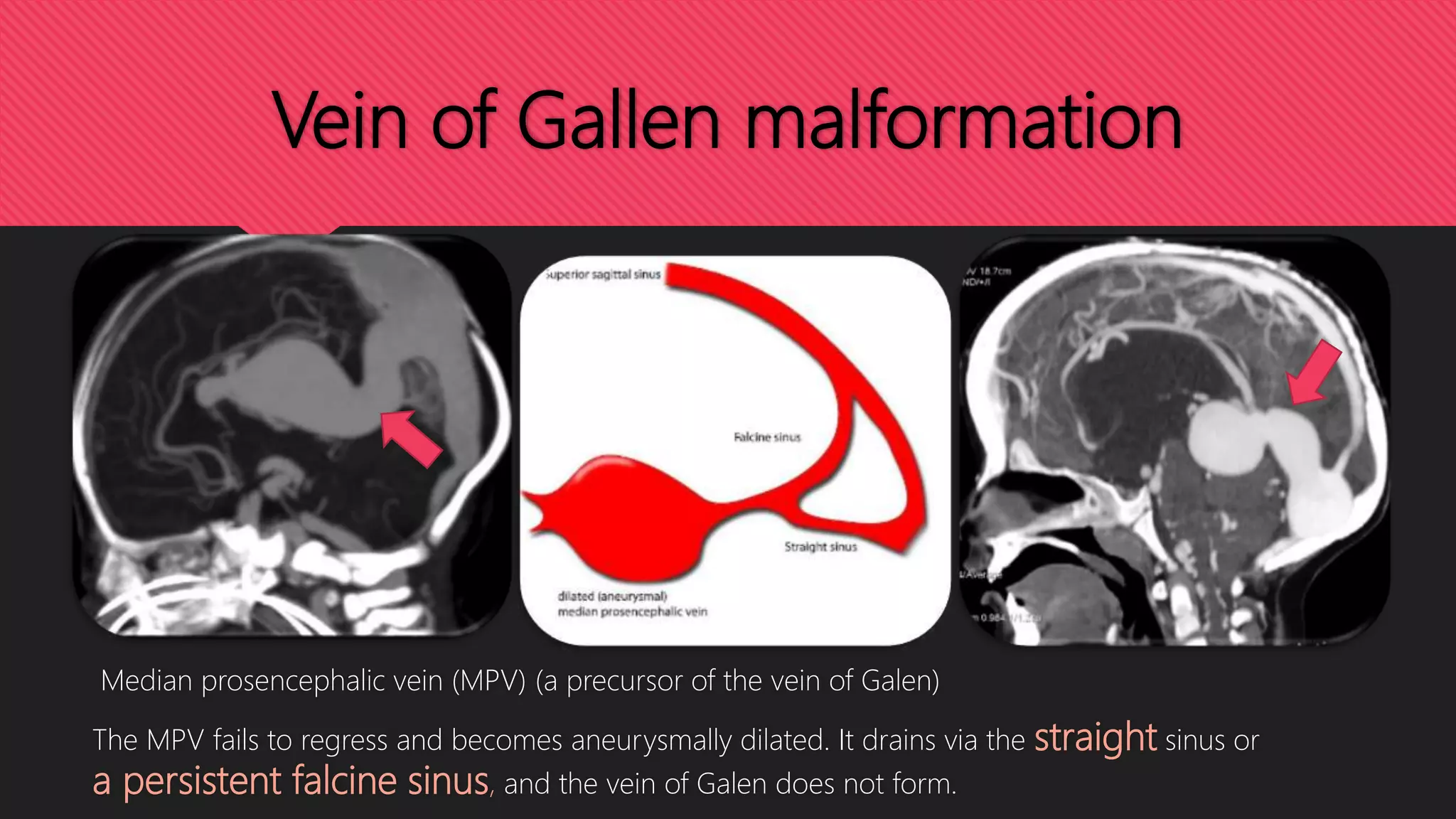 Intervention signs | PPTX