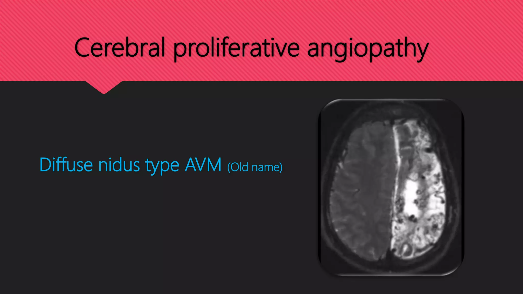 Intervention signs | PPTX