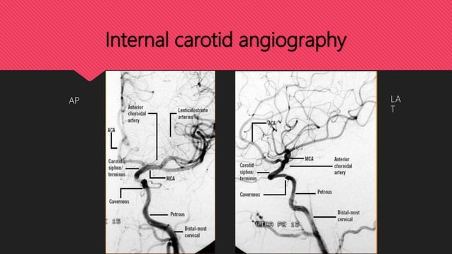 Intervention signs | PPT