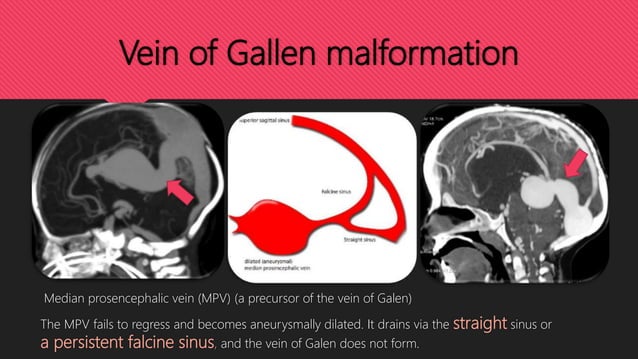 Intervention signs | PPT