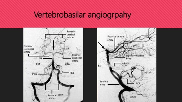 Intervention signs | PPT