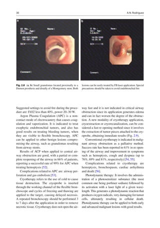 Interventions in pulmonary medicine | PDF