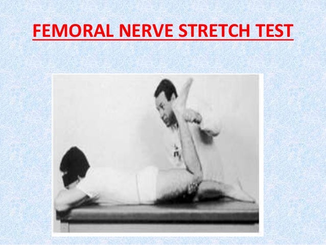 Intervertebral disc prolapese