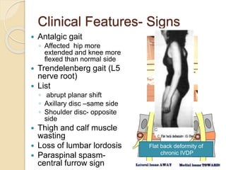 Lumbar Intervertebral disc prolapse | PPTX