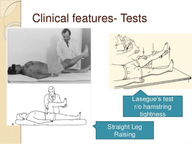 Lumbar Intervertebral disc prolapse