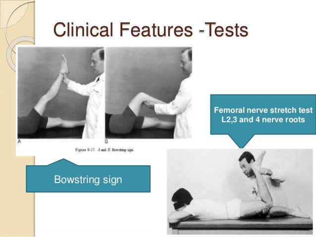Lumbar Intervertebral disc prolapse