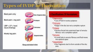 Intervertebral Disc Prolapse | PPTX