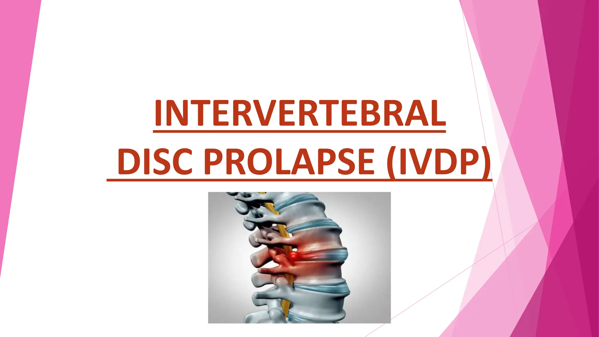 PPT ON INTERVERTEBRAL DISC PROLAPSE CLASS | PPTX