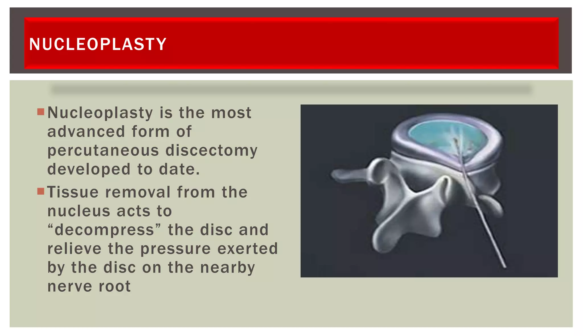 Intervertebral disc prolapse(ivdp) | PPTX