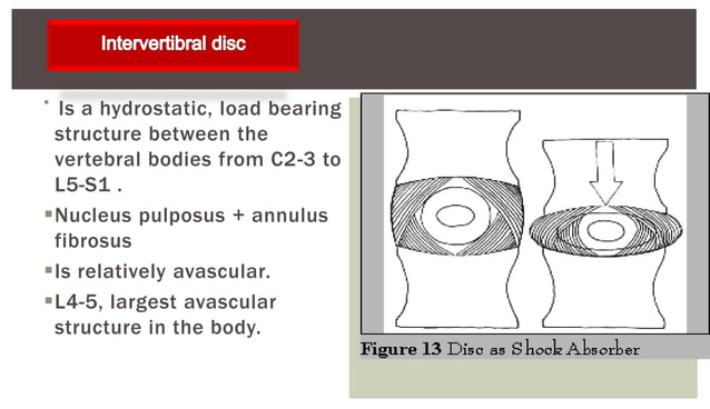Intervertebral disc prolapse(ivdp) | PPTX | Bone and Joint Conditions ...