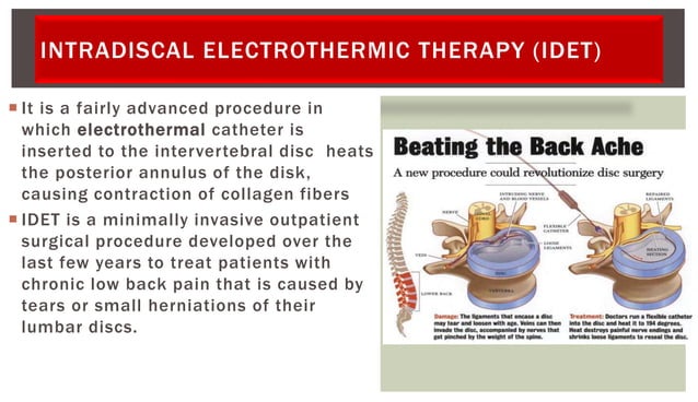 Intervertebral disc prolapse(ivdp) | PPTX | Bone and Joint Conditions ...