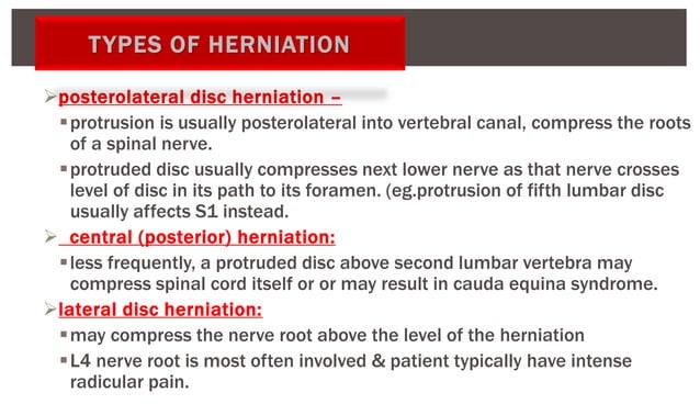 Intervertebral disc prolapse(ivdp) | PPTX | Bone and Joint Conditions ...