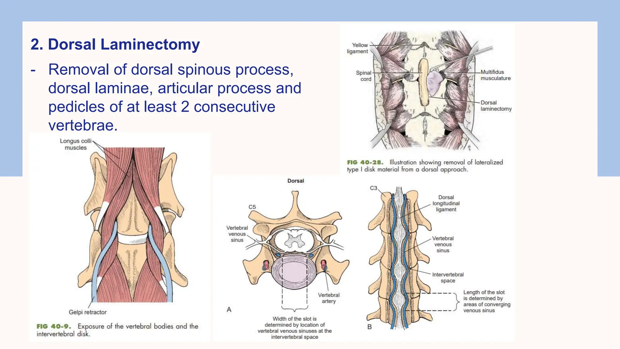 INTERVERTEBRAL DISC PROTRUSION in Dogs.pptx