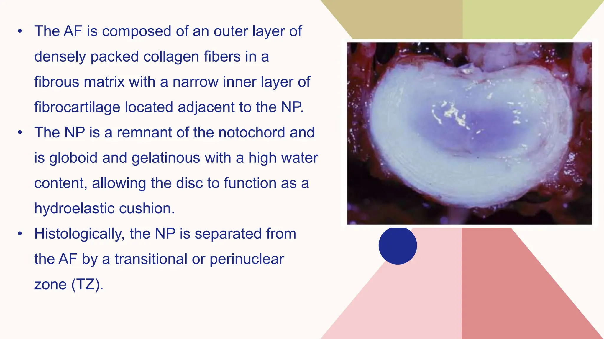 INTERVERTEBRAL DISC PROTRUSION in Dogs.pptx