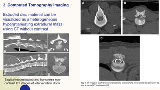 INTERVERTEBRAL DISC PROTRUSION in Dogs.pptx