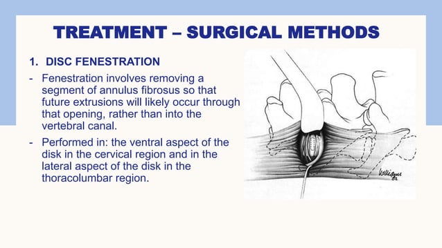 INTERVERTEBRAL DISC PROTRUSION in Dogs.pptx | Bone and Joint Conditions ...