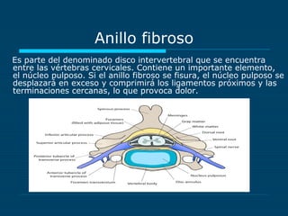 Intervertebrales | PPT