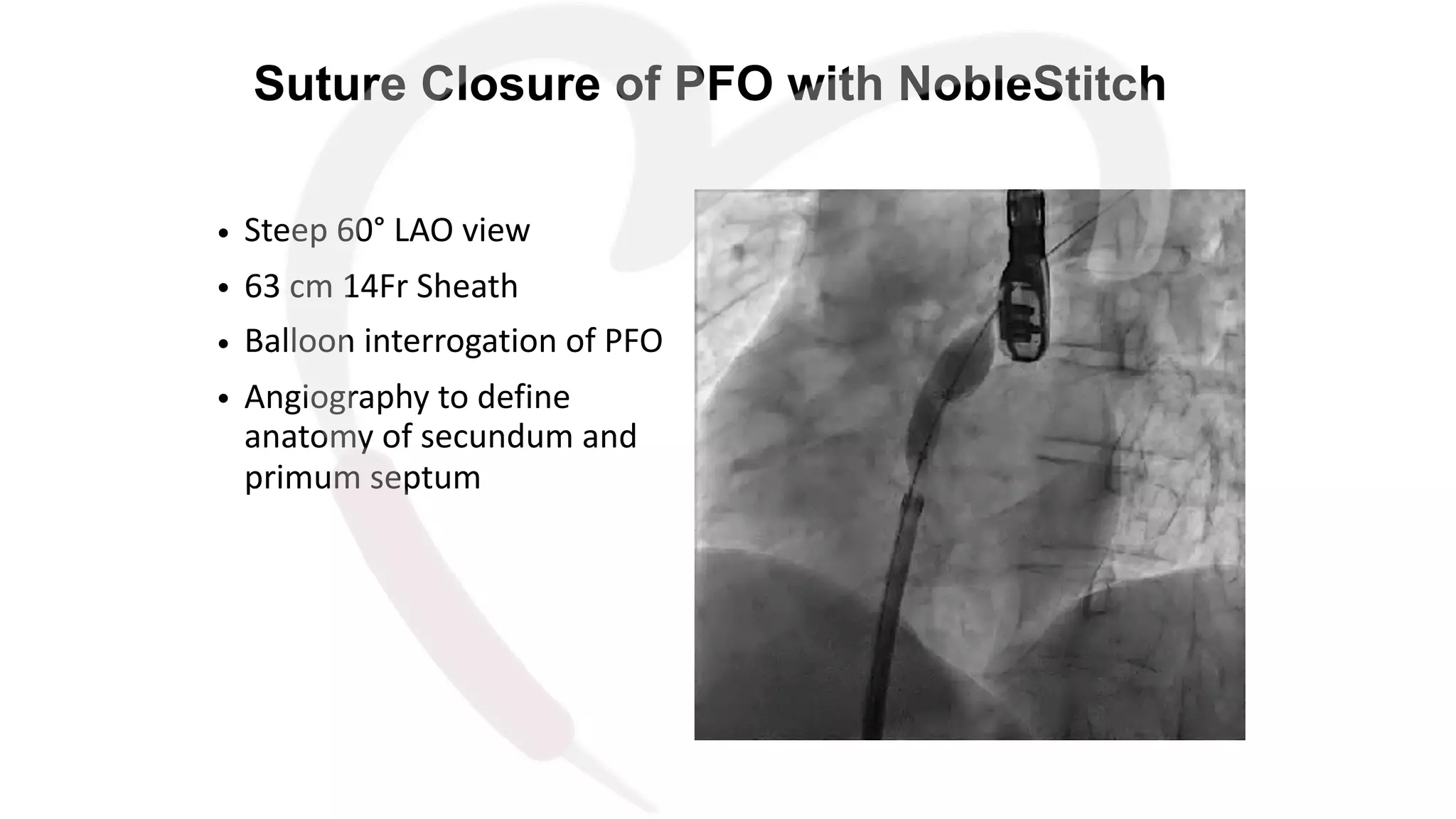 Intervencionismo estructural | PDF
