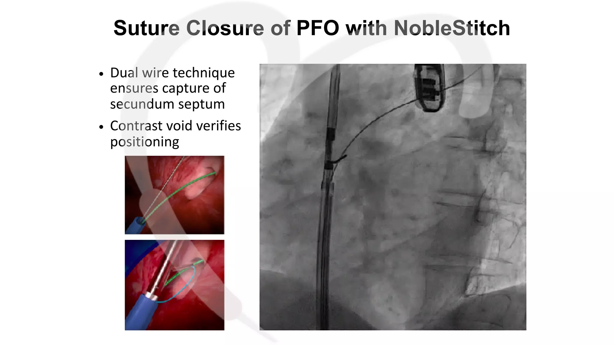 Intervencionismo estructural | PDF