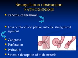 Intestinal Obstruction .DR MAHIPAL., INDIA | PPT