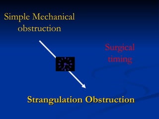 Intestinal Obstruction .DR MAHIPAL., INDIA | PPT