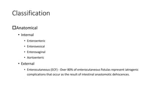 Intestinal Fistula | PPTX