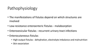 Intestinal Fistula | PPTX