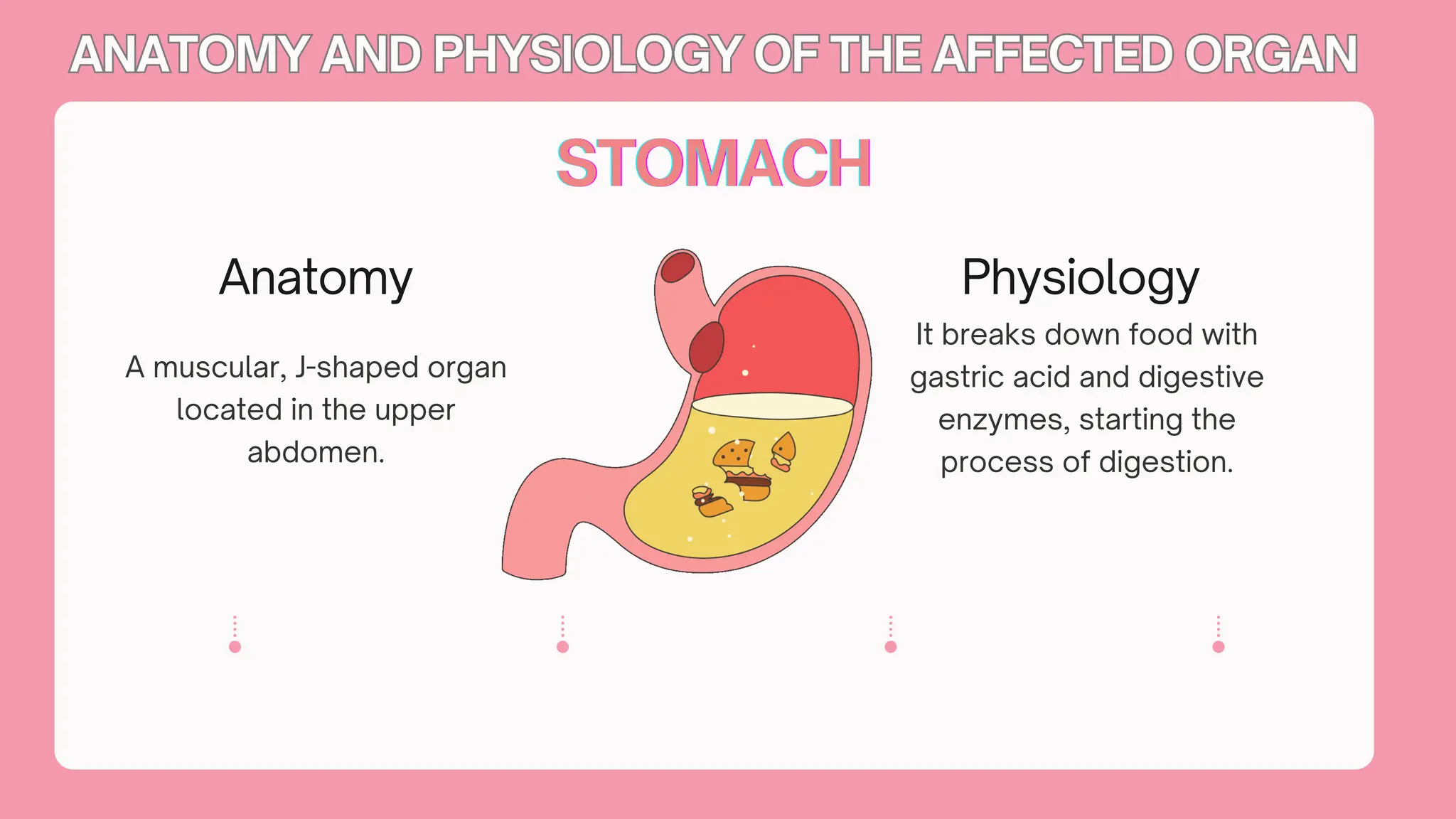 Intestinal Fistula.pdf health allied.com