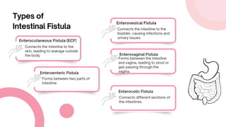 Intestinal Fistula.pdf health allied.com