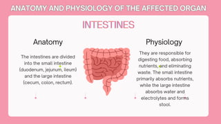 Intestinal Fistula.pdf health allied.com