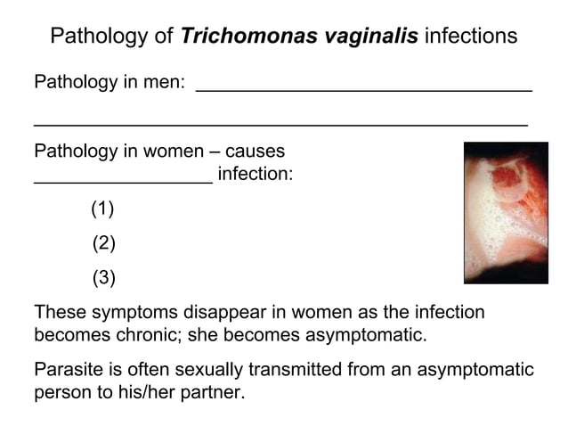 Intestinal Flagellates | PPT