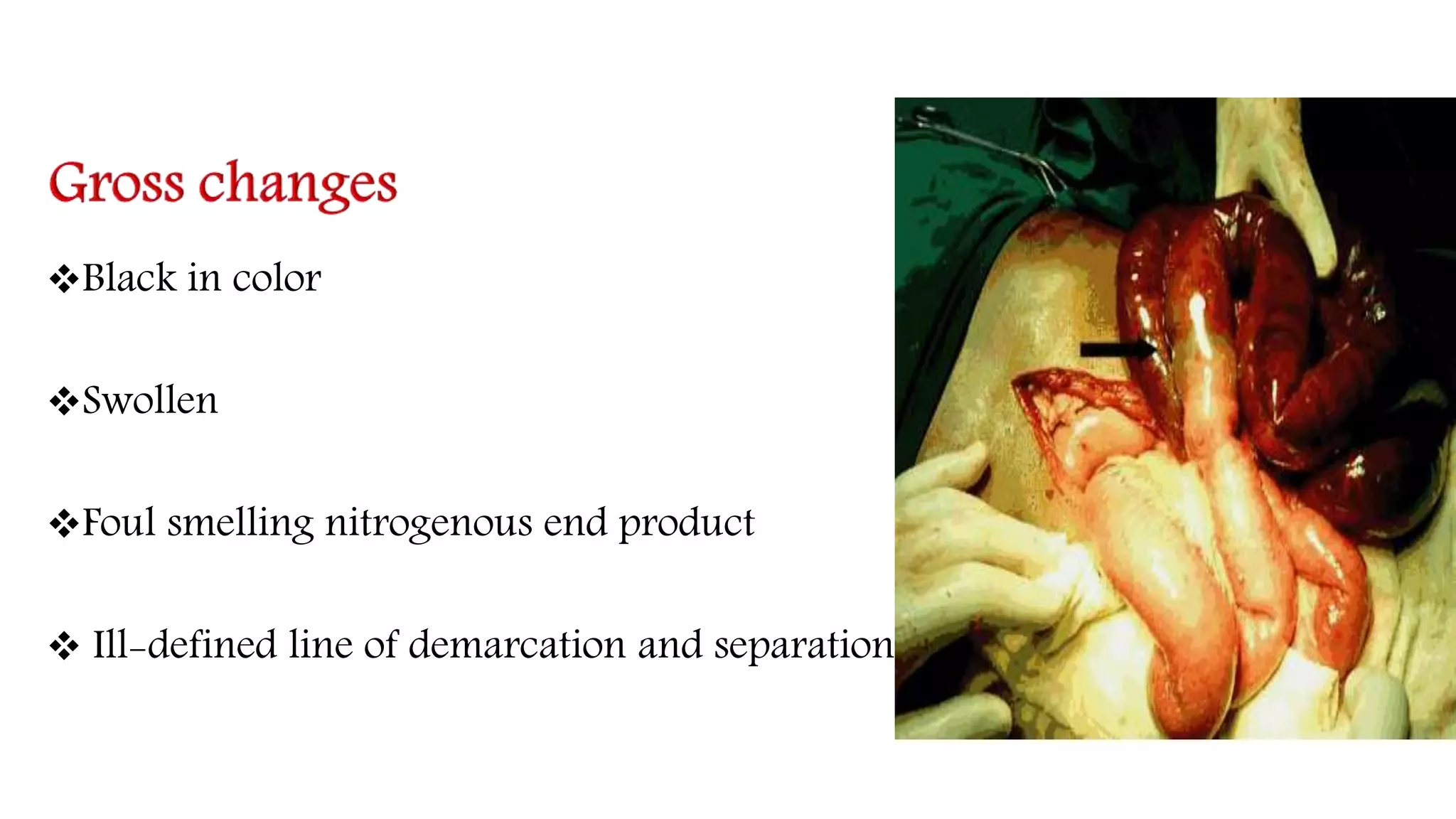 Intestinal gangrene | PPTX