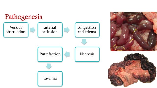Intestinal gangrene | PPTX