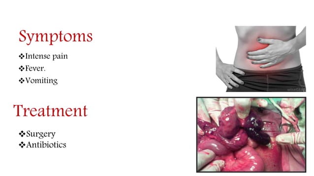 Intestinal gangrene | PPTX