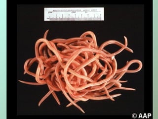 Intestinal helminths | PPT