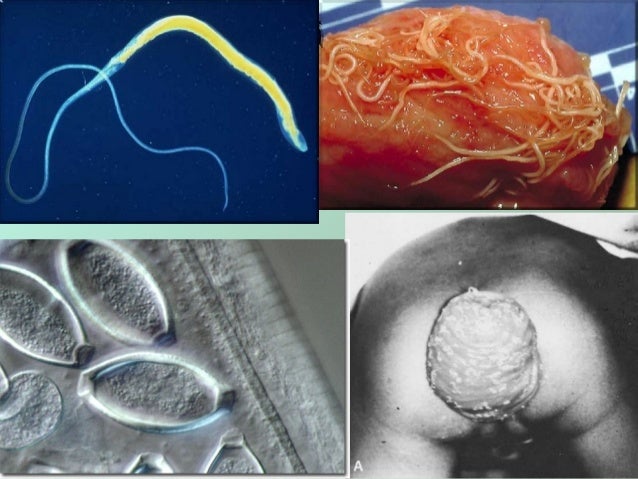 Intestinal helminths