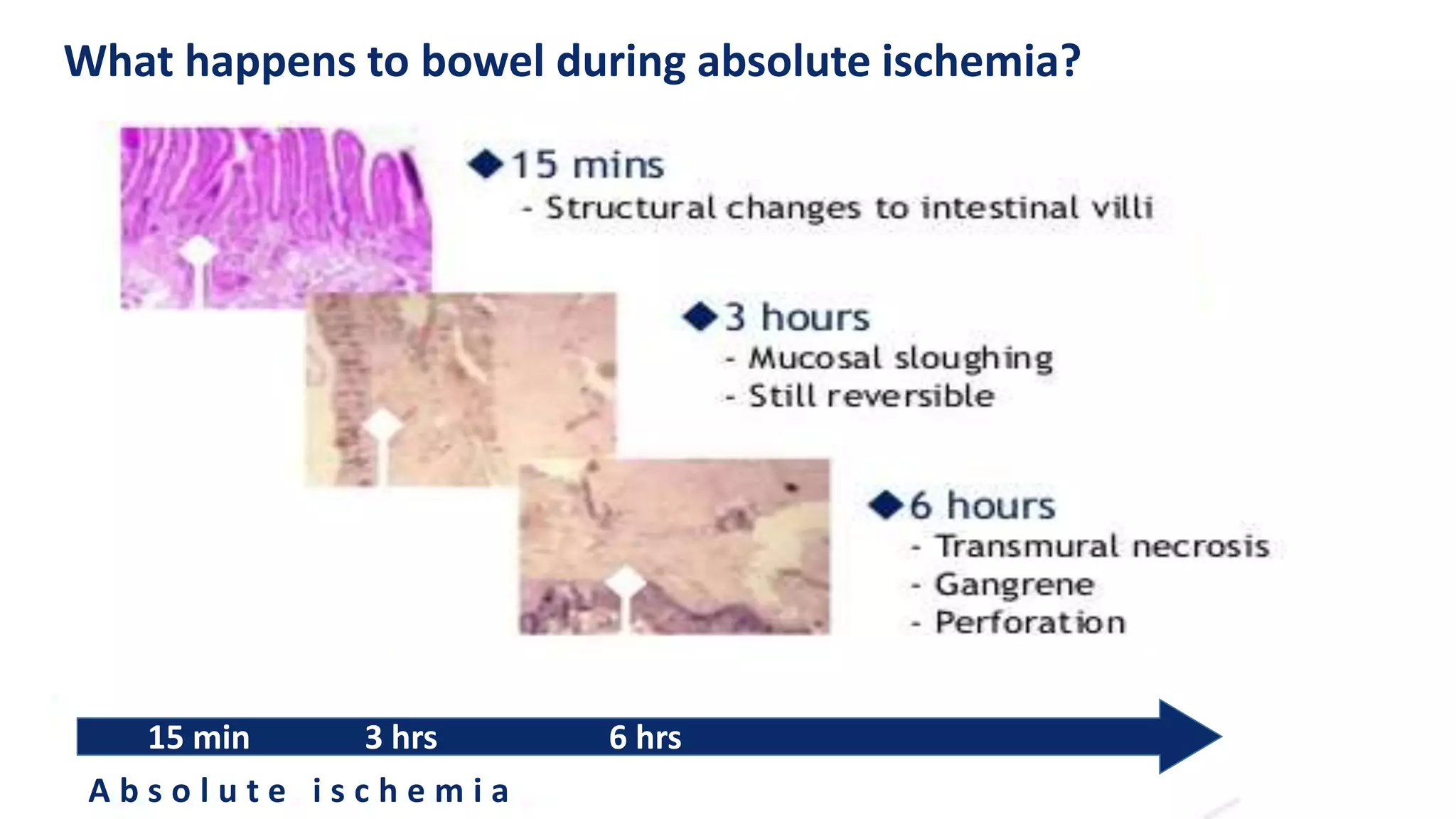 Intestinal ischemia | PPTX