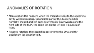 INTESTINAL MALROTATION EXPLAINED; spot the signs before a Medical ...