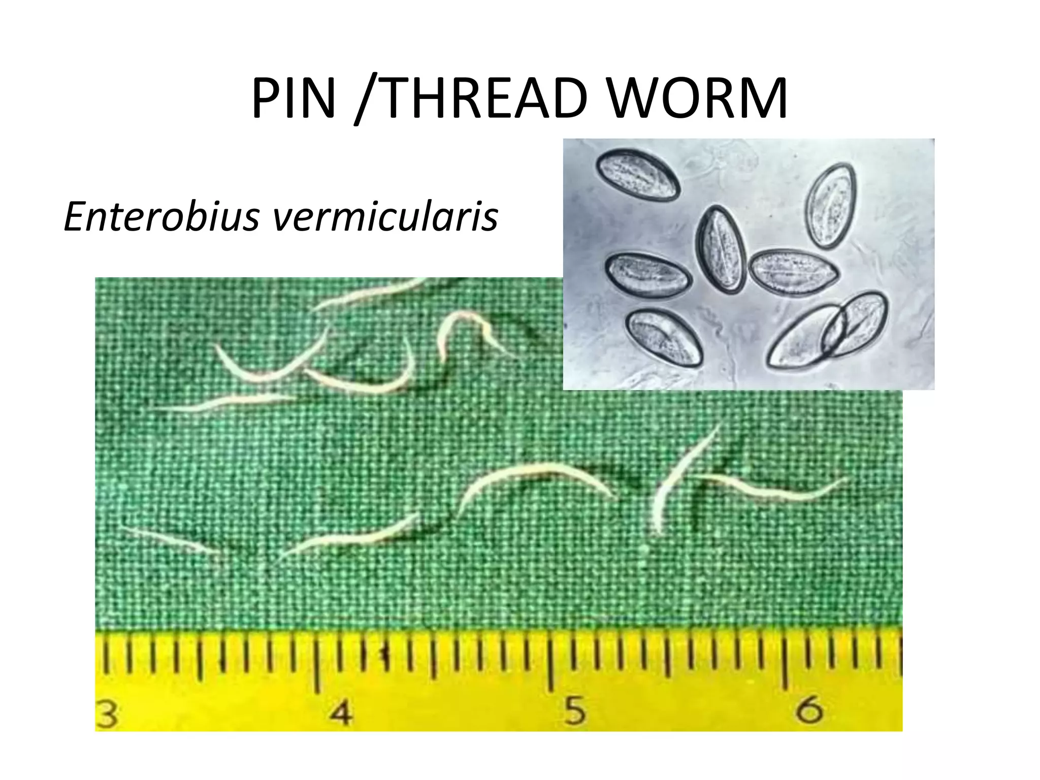 Intestinal nematodes | PPTX