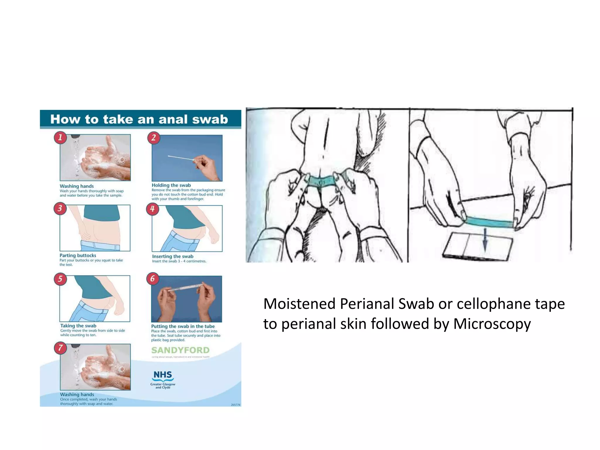 Intestinal nematodes | PPTX