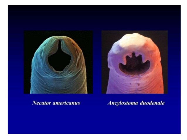 Intestinal nematodes