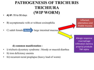Intestinal nematodes | PPTX