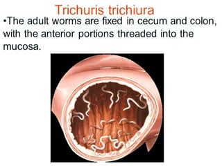 INTESTINAL NEMATODES-ASCARIS, Trichiura, Entrobius.ppt