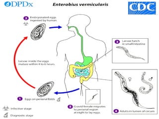 INTESTINAL NEMATODES-ASCARIS, Trichiura, Entrobius.ppt